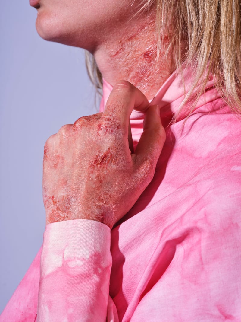 Poetics of Care - UAL Showcase